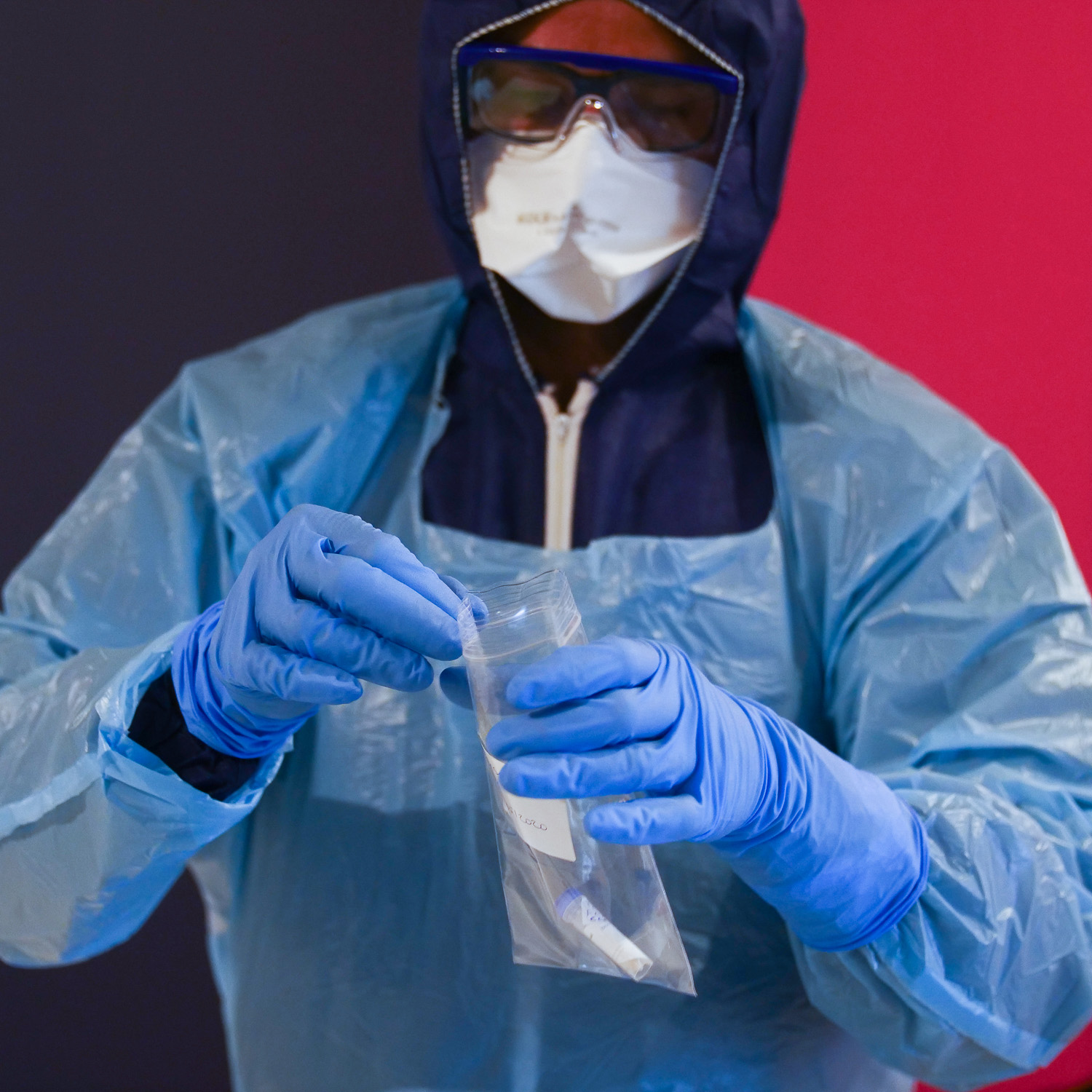 Biological marker predicts COVID-19 prognosis | Champalimaud Foundation