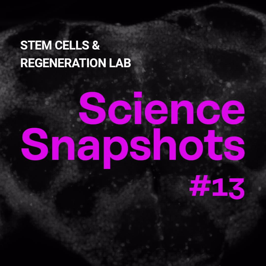 Science Snapshot: (Re) Generating Neurons | Champalimaud Foundation Science Snapshot: (Re) Generating Neurons | Champalimaud Foundation
